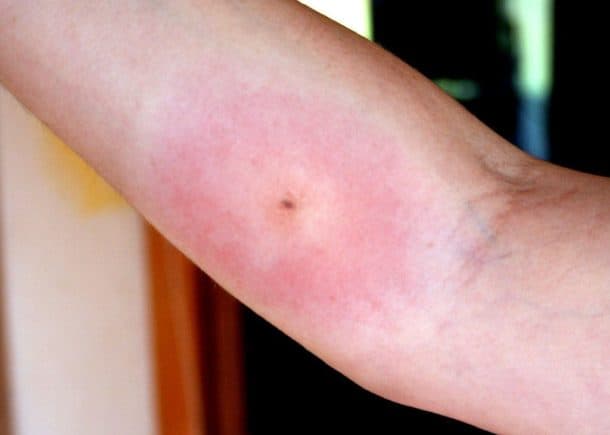 Poisonous Spiders to Avoid - Black Widow and Brown Recluse