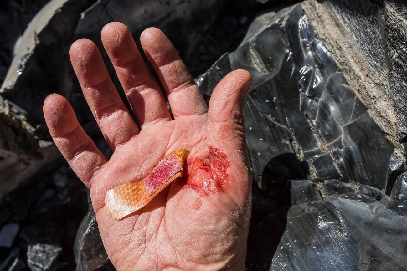 Caring For Wounds In The Field